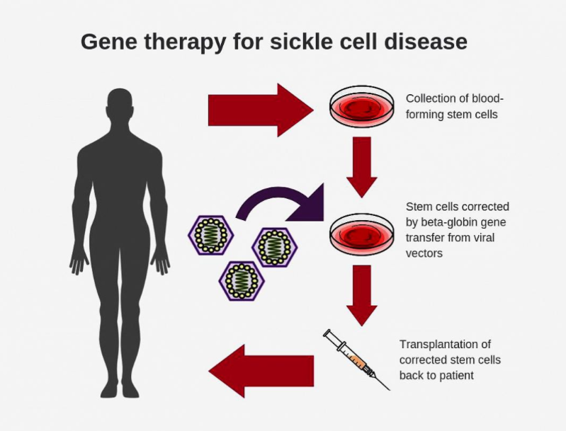 gene-therapy-sickle-cell.png | Amgen Biotech Experience